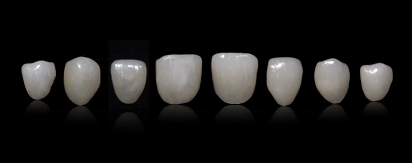 Digital face-bow transfer technique dentofacial analyser for dental ...